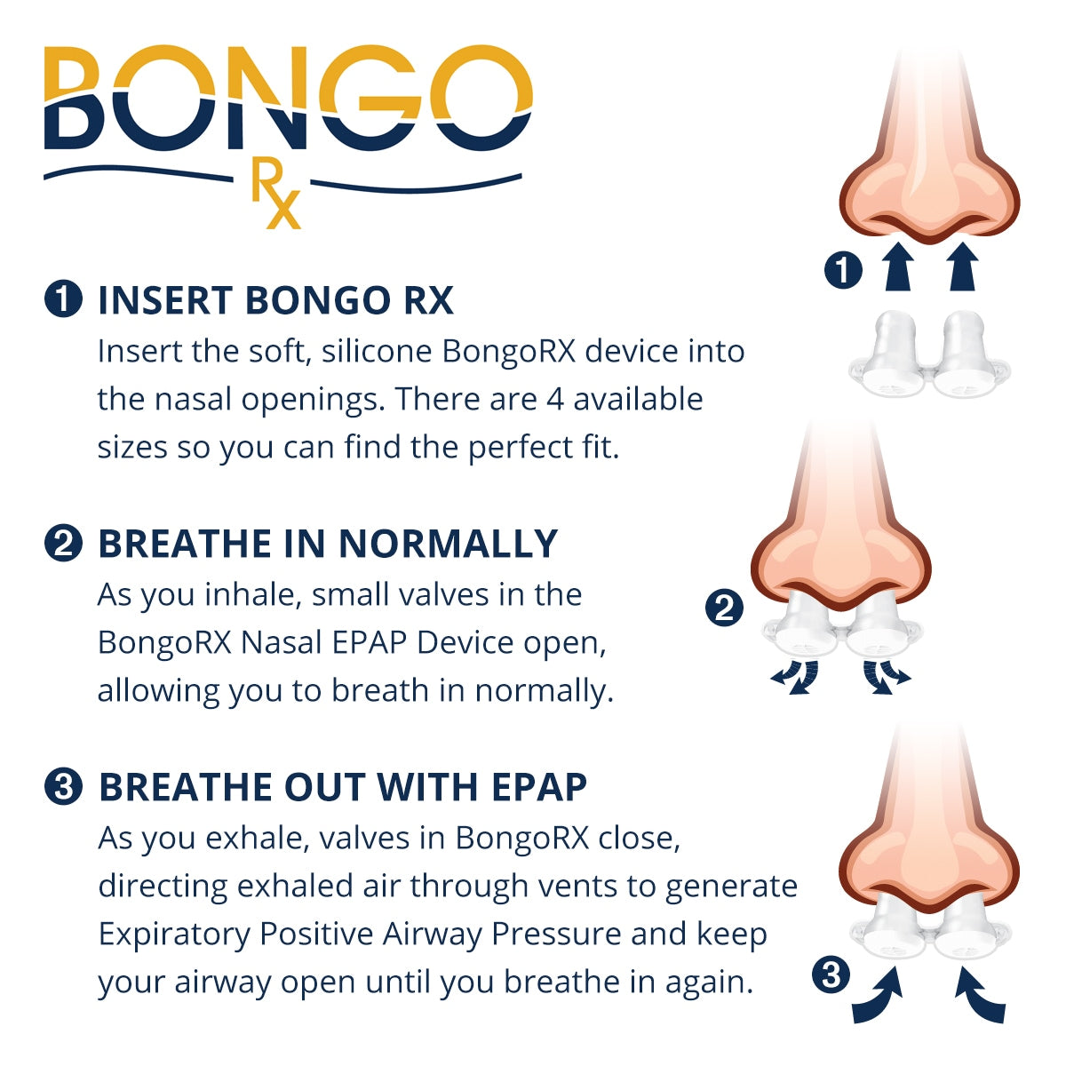 Bongo RX EPAP Therapy Device Starter Kit – DirectHomeMedical
