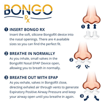 Bongo RX EPAP Therapy Device Starter Kit – DirectHomeMedical